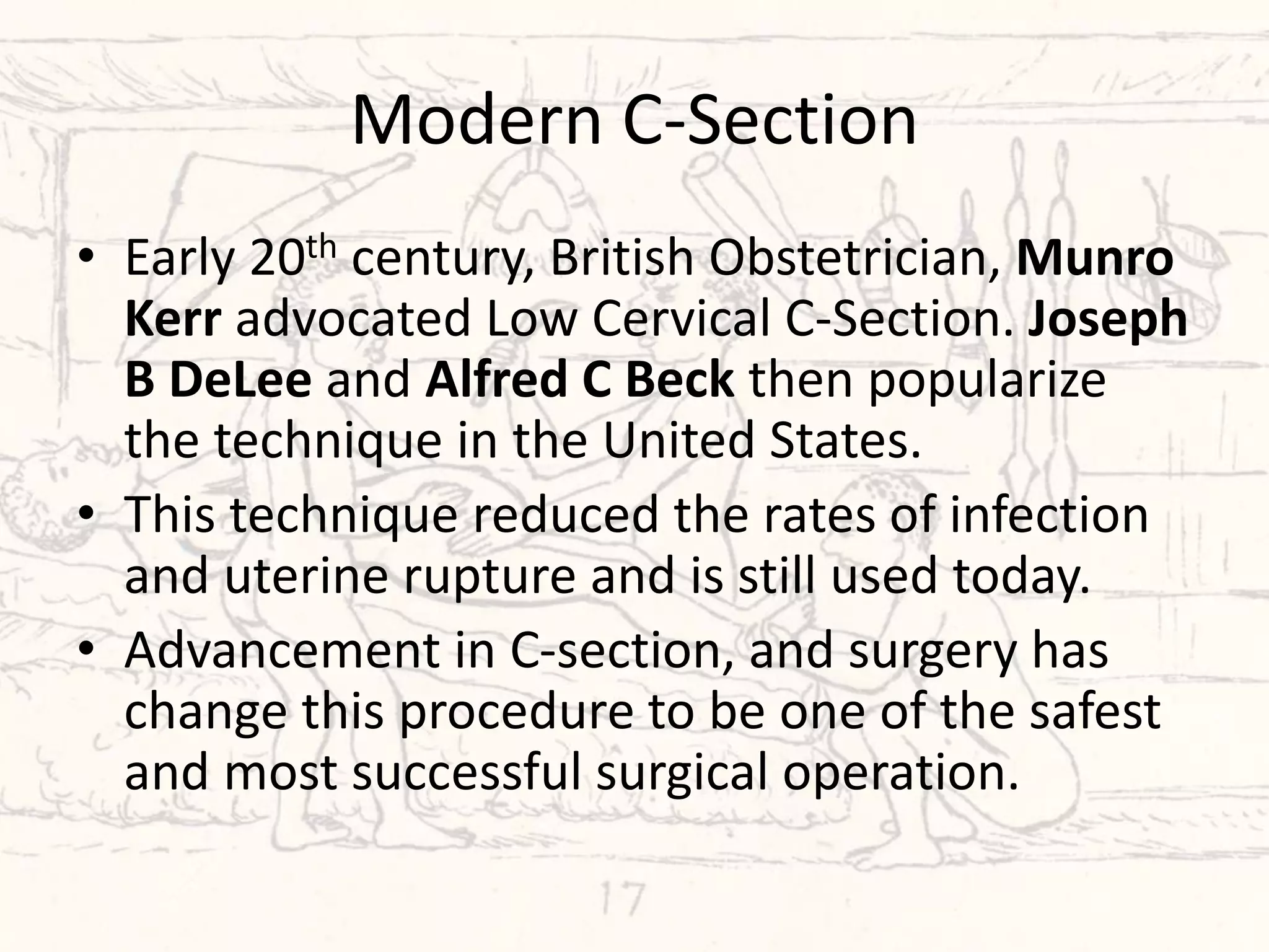 The Brief History of Caesarean Section | PPTX