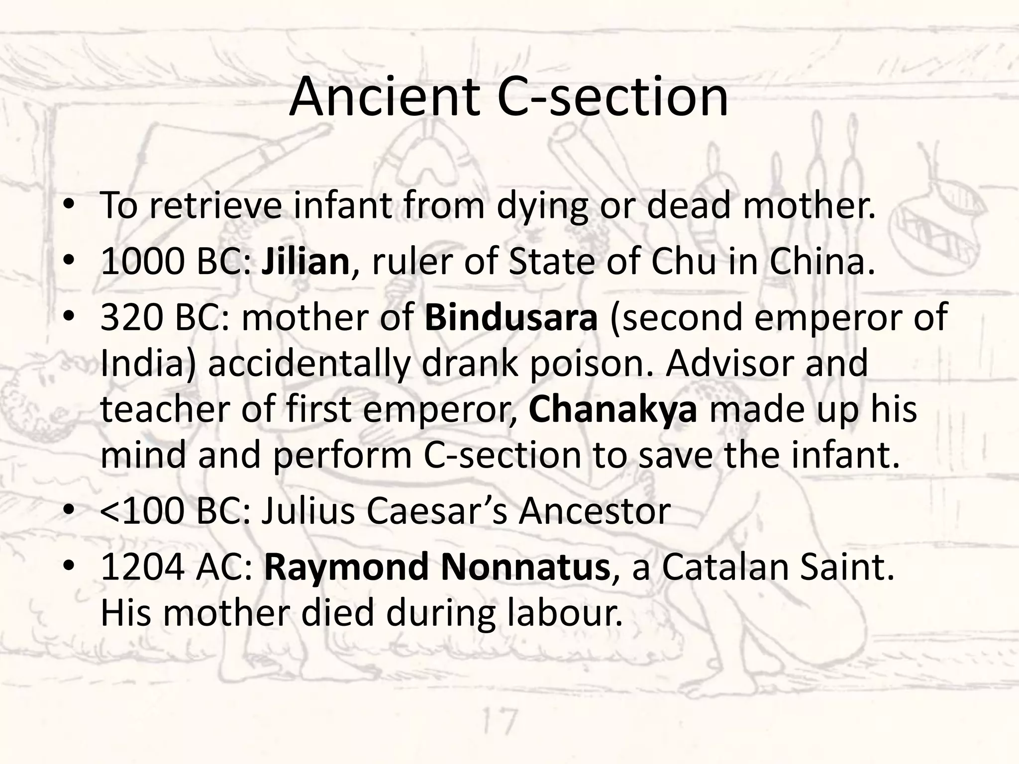 The Brief History of Caesarean Section | PPTX