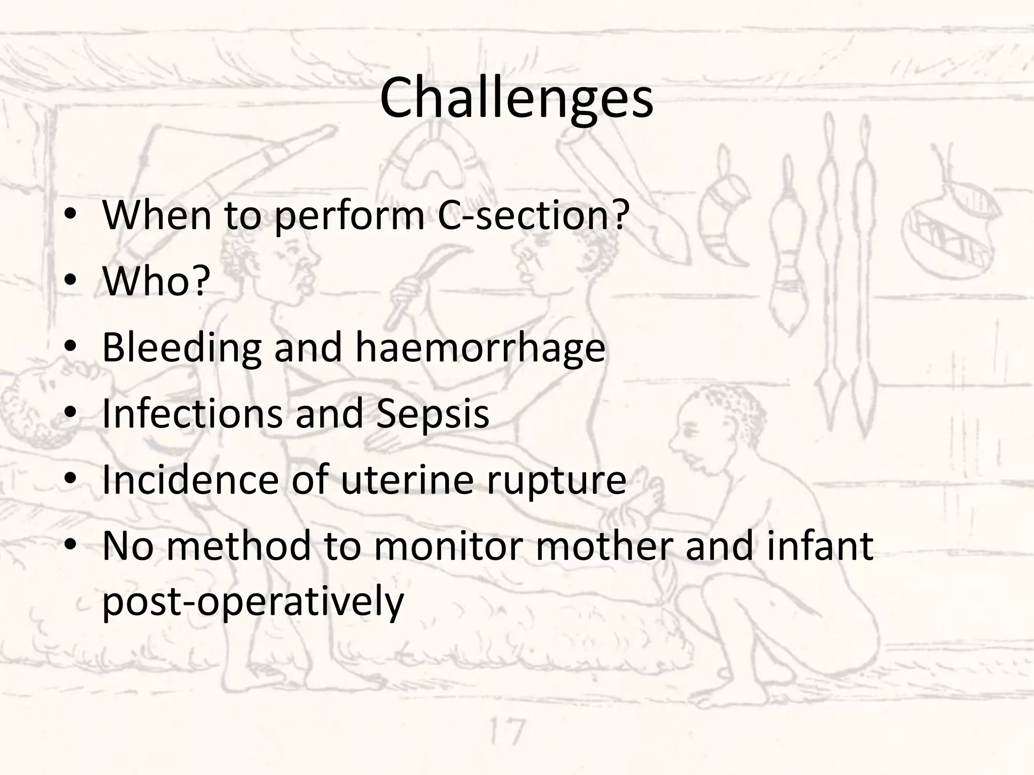The Brief History of Caesarean Section | PPTX