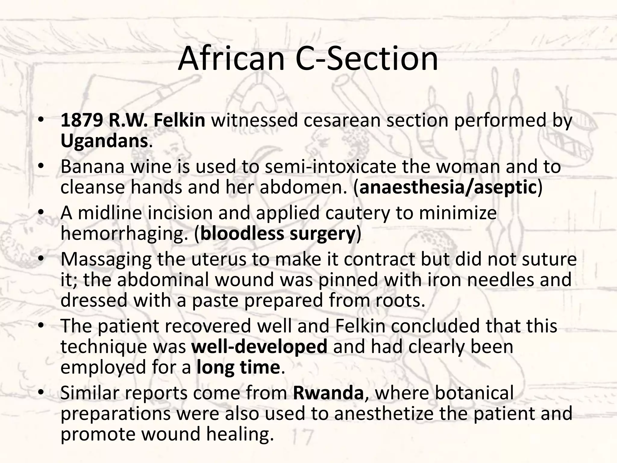 The Brief History of Caesarean Section | PPTX
