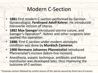 The Brief History of Caesarean Section | PPTX