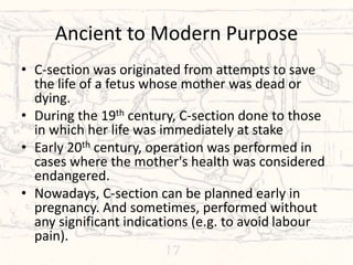 The Brief History of Caesarean Section | PPTX
