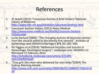 The Brief History of Caesarean Section | PPTX