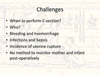 The Brief History of Caesarean Section | PPTX