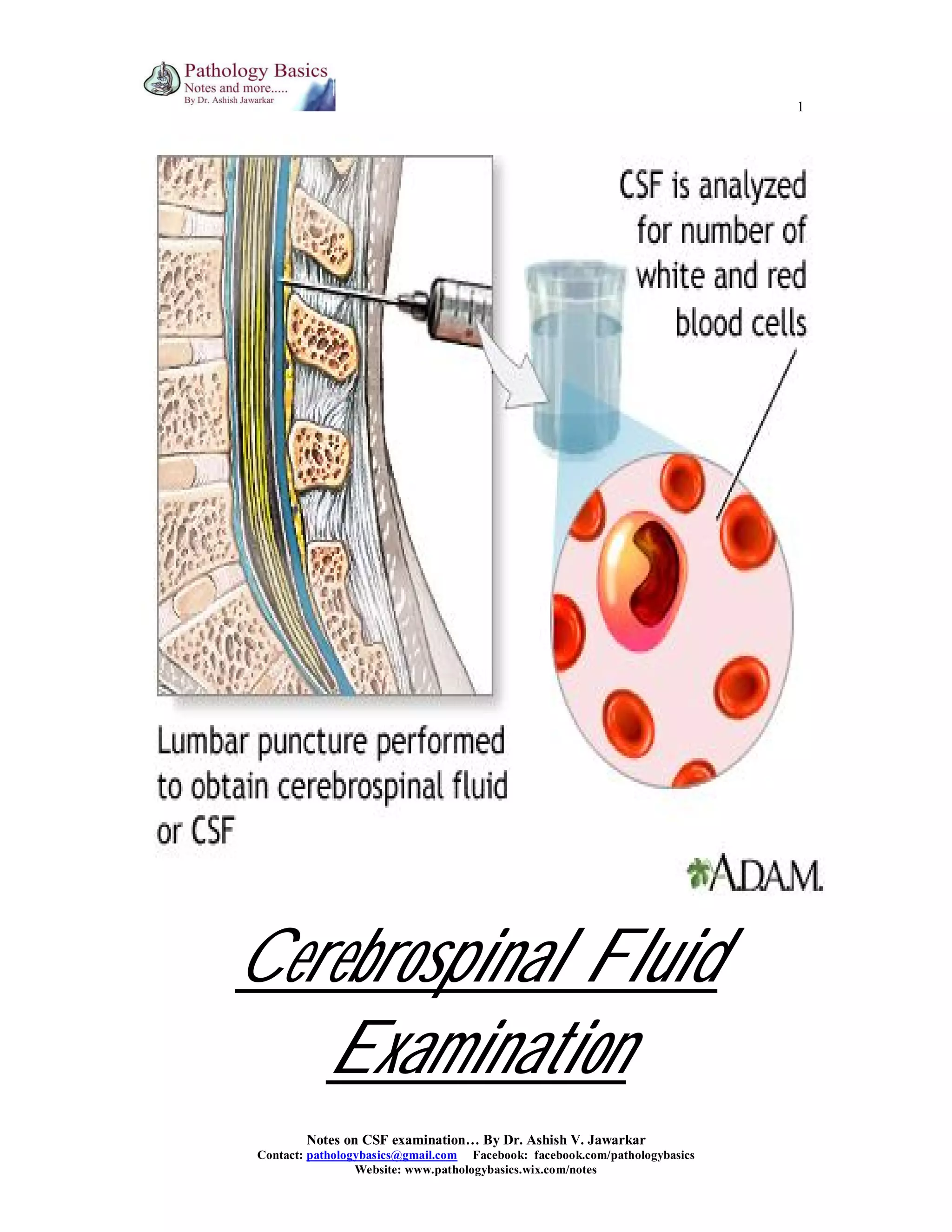 CSF - Cerebrospinal fluid examination - from tapping to pathological ...