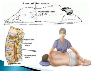 cerebrospinal fluid examination CSF study | PDF | Blood Disorders | Diseases and Conditions