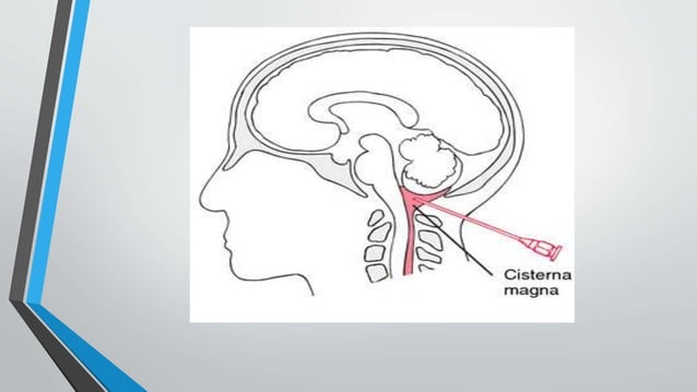 CSF-function, properties, circulation formation.pptx