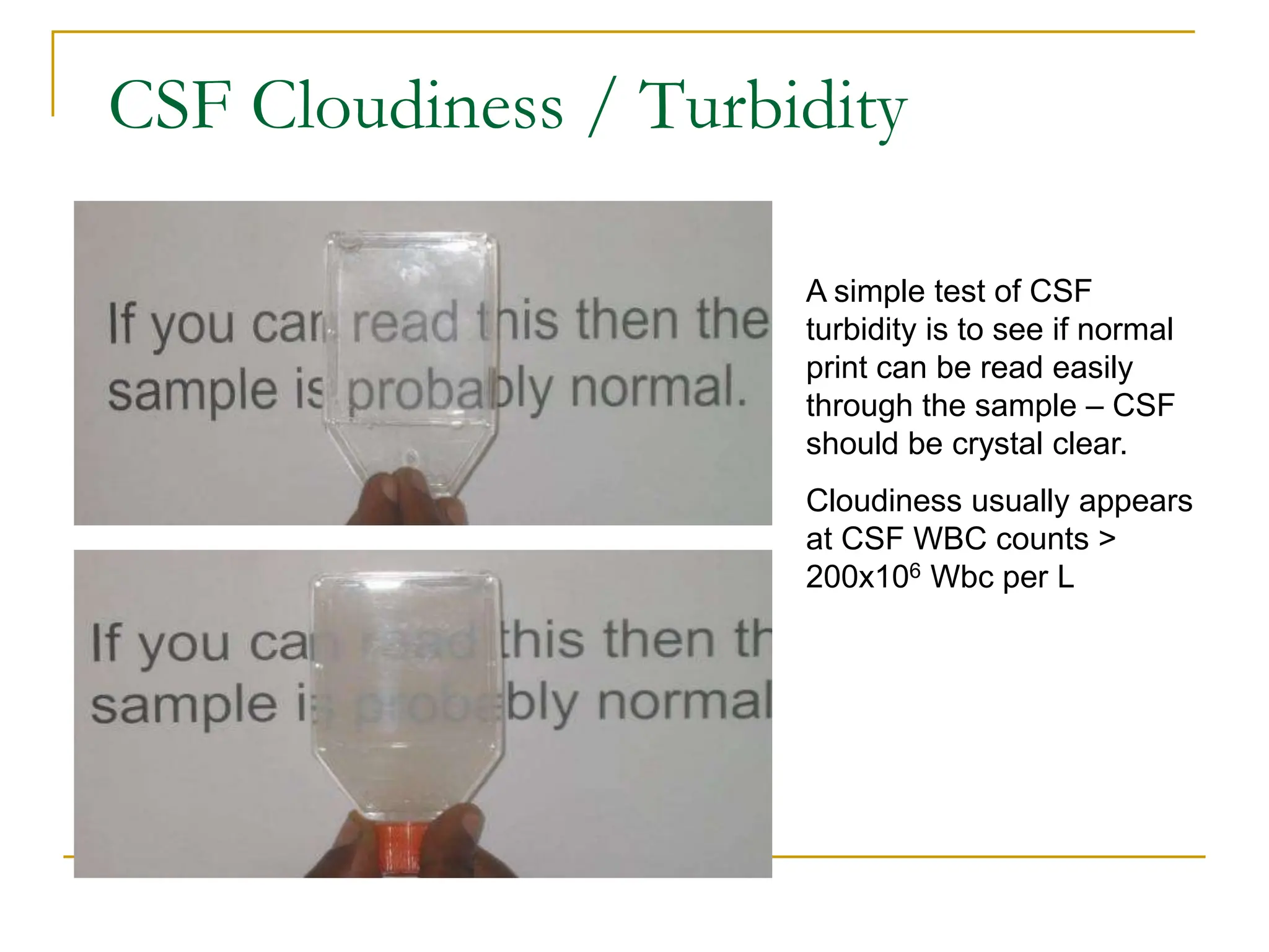 CSF CNS covered by 3 membranes [meninges] pdf | PDF