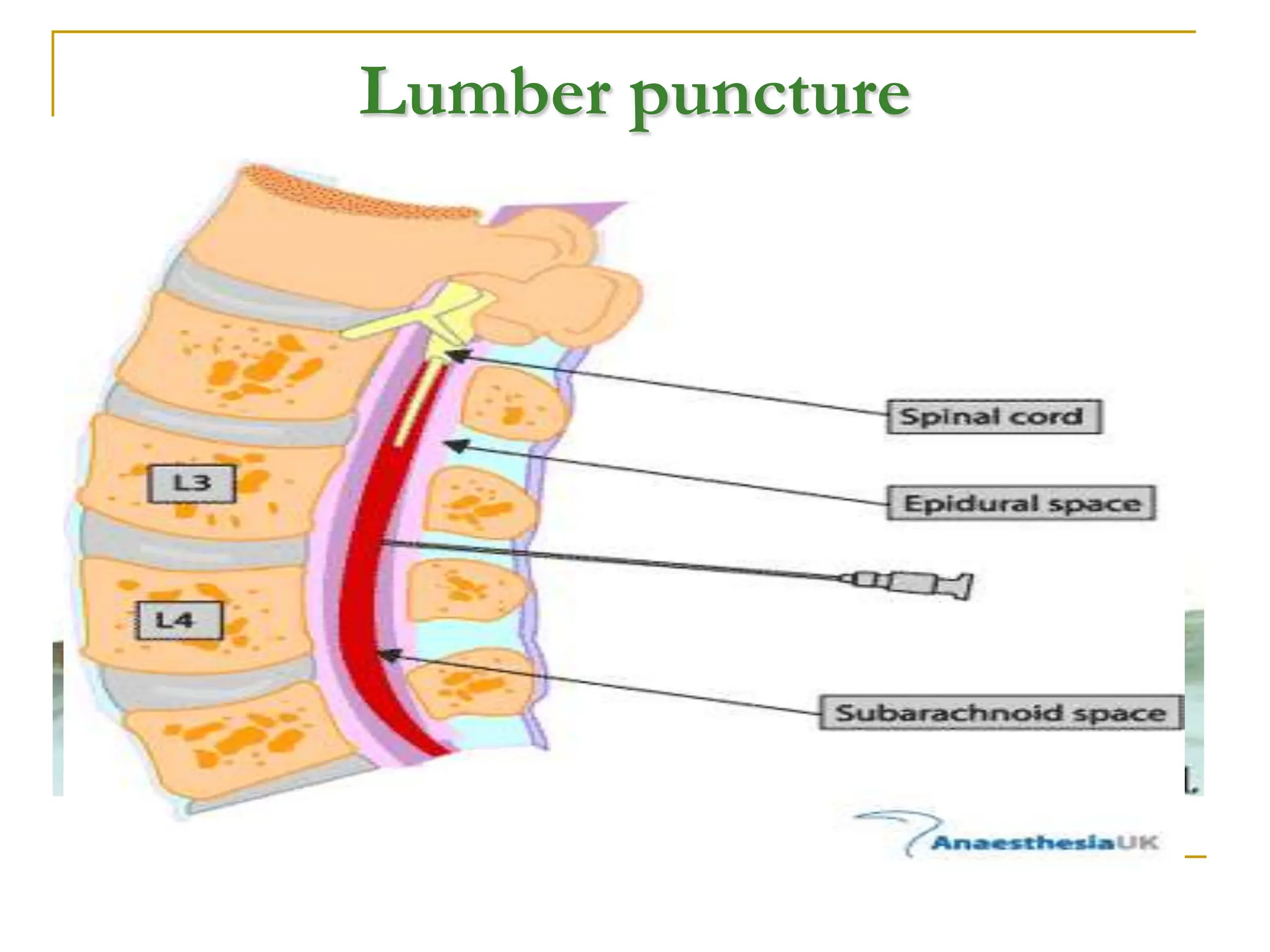 CSF CNS covered by 3 membranes [meninges] pdf | PDF