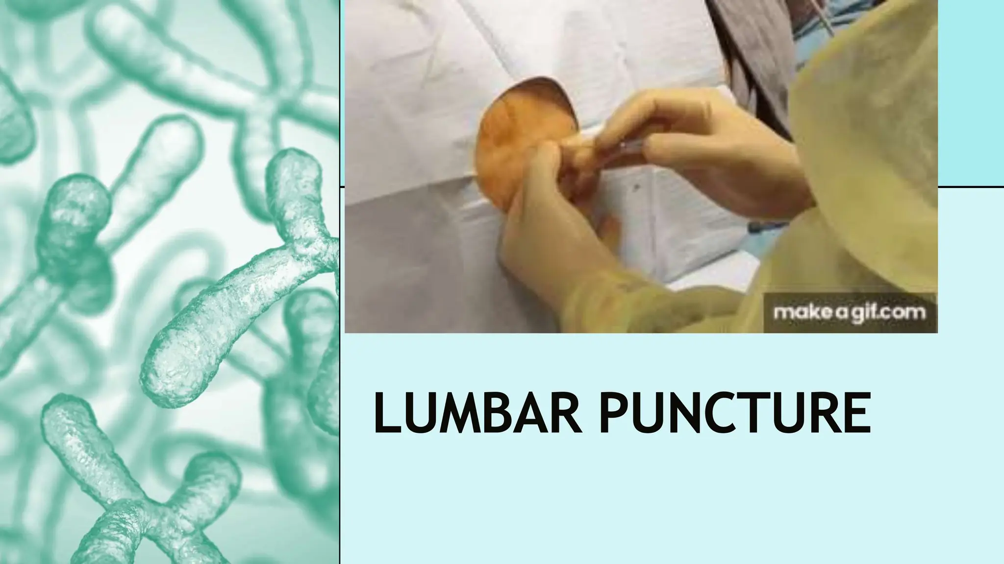 Abnormal CSF Diagnosis and Lumbar puncture | PPTX