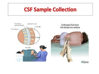 lecture : physiology of cerebrovascular fluid (CSF) | PPTX