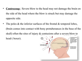 lecture : physiology of cerebrovascular fluid (CSF) | PPTX