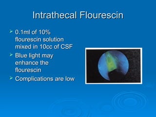 CSF leaks slides Diagnosis and Management | PPT