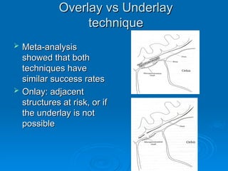 CSF leaks slides Diagnosis and Management | PPT