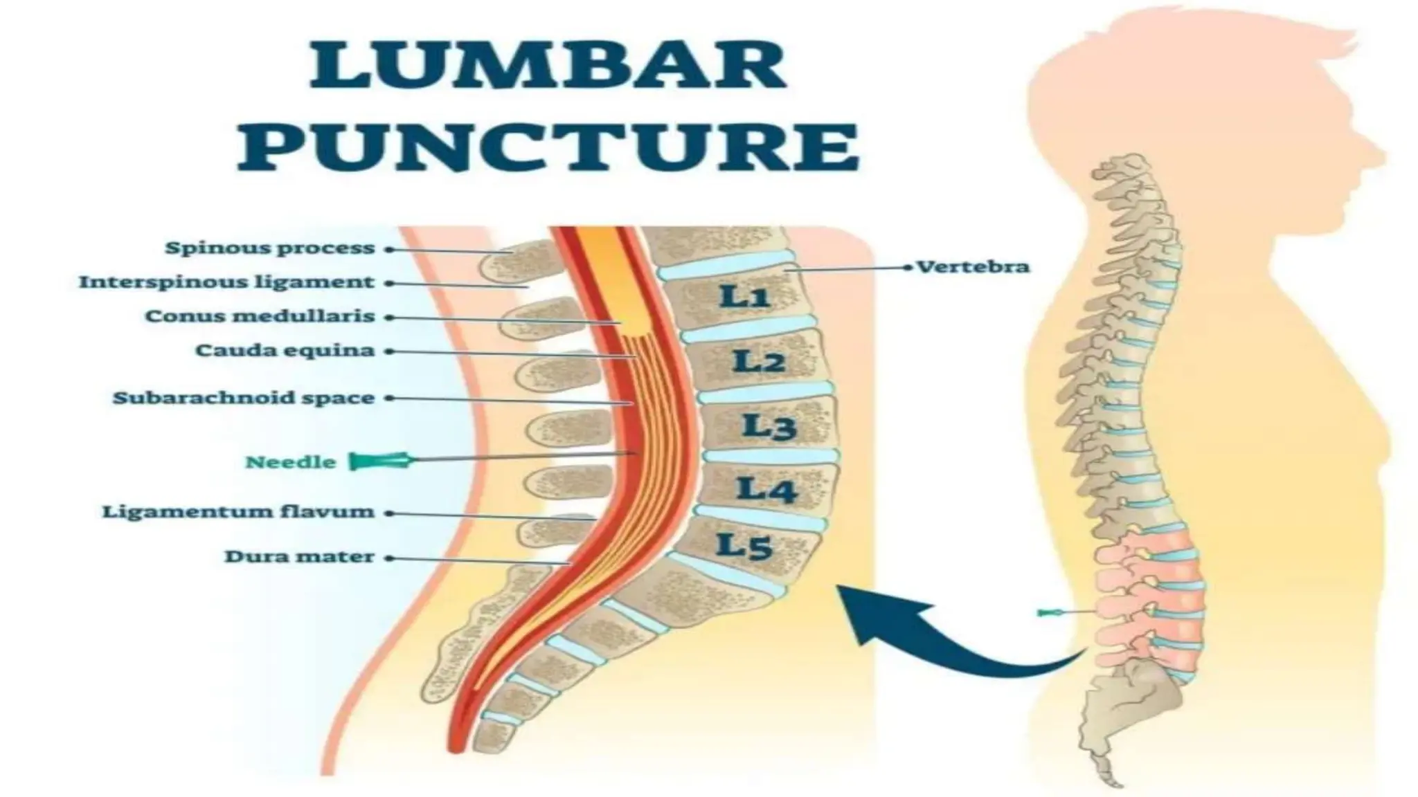 CSF-Pathway all aspect covered (anatomical and physiological) | PPTX