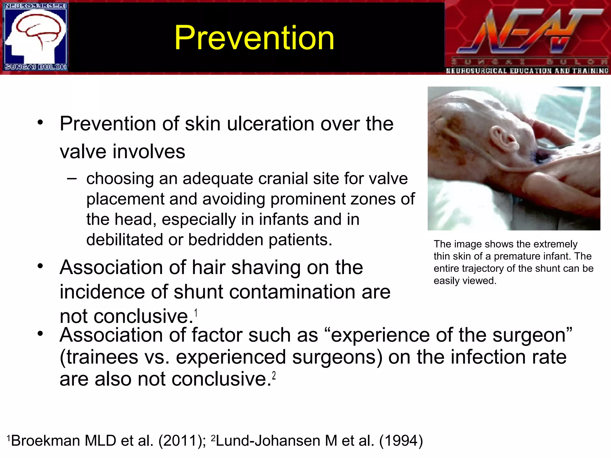 CSF Shunt Infection: Diagnosis and Treatment | PPT