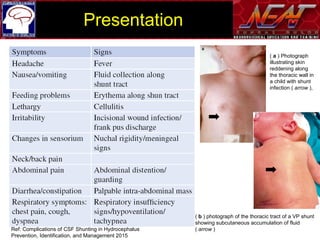 CSF Shunt Infection: Diagnosis and Treatment | PPT