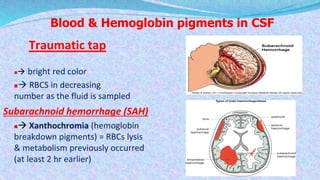 CEREBROSPINAL FLUID (CSF) | PPTX