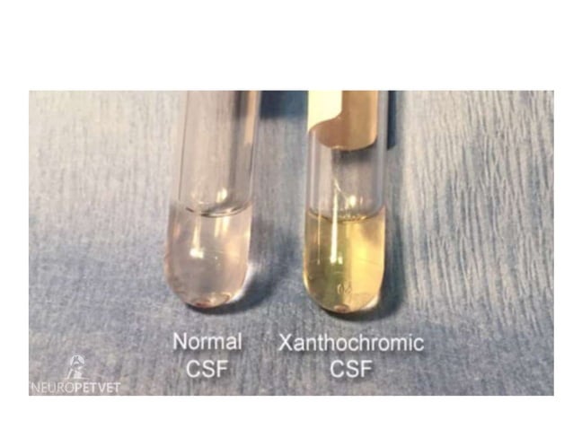 CSF ANALYSIS.pptx