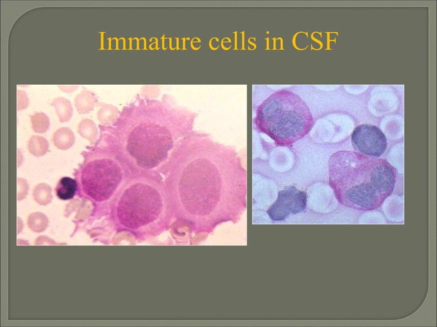 Csf analysis presentation | PPT | Blood Disorders | Diseases and Conditions