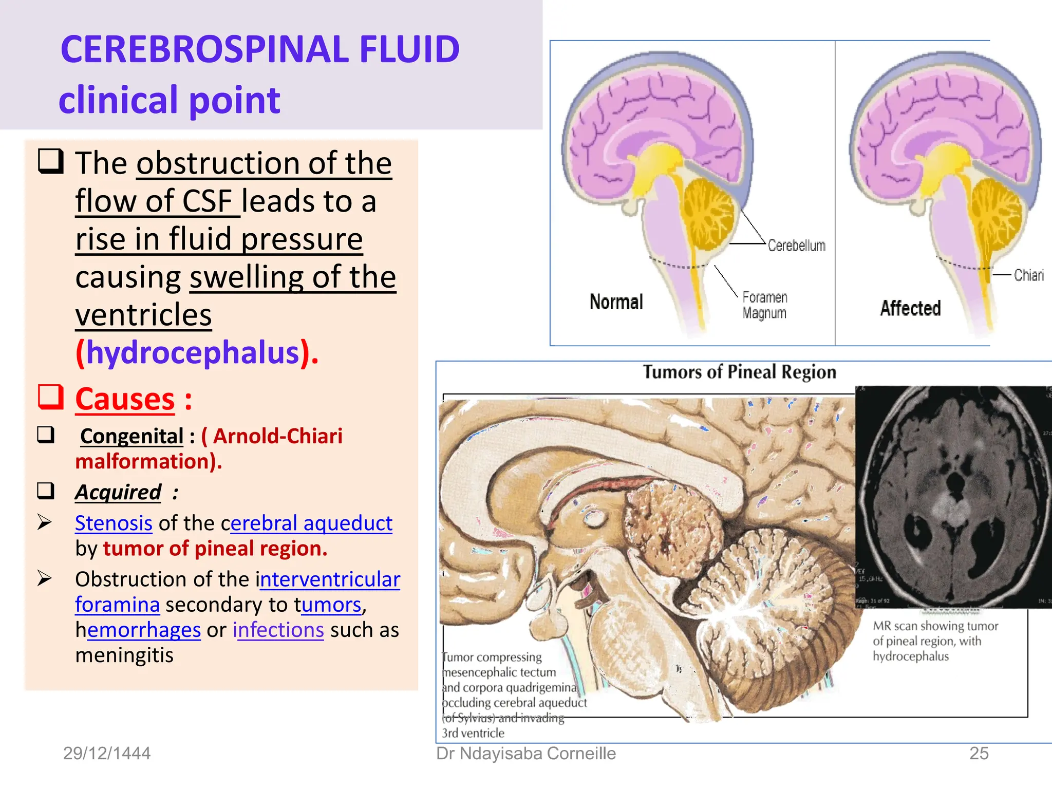 Cerebral Spinal Fluid (csf) AND VENTRICLES | PDF