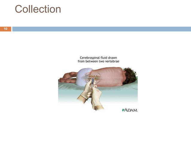 CSF & Body Cavity Fluid Examination.ppt | Brain and Nervous System ...