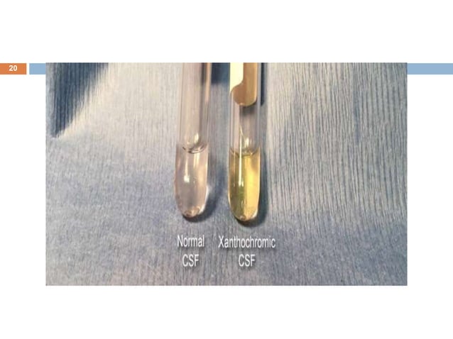 CSF & Body Cavity Fluid Examination.ppt | Brain and Nervous System ...