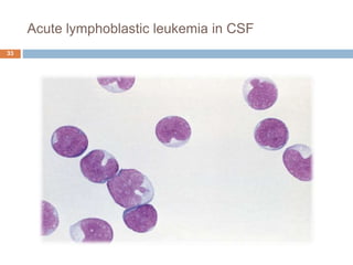 CSF & Body Cavity Fluid Examination.ppt