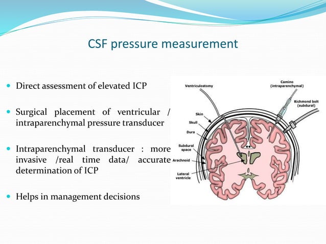 CSF circulation disorders | PPTX