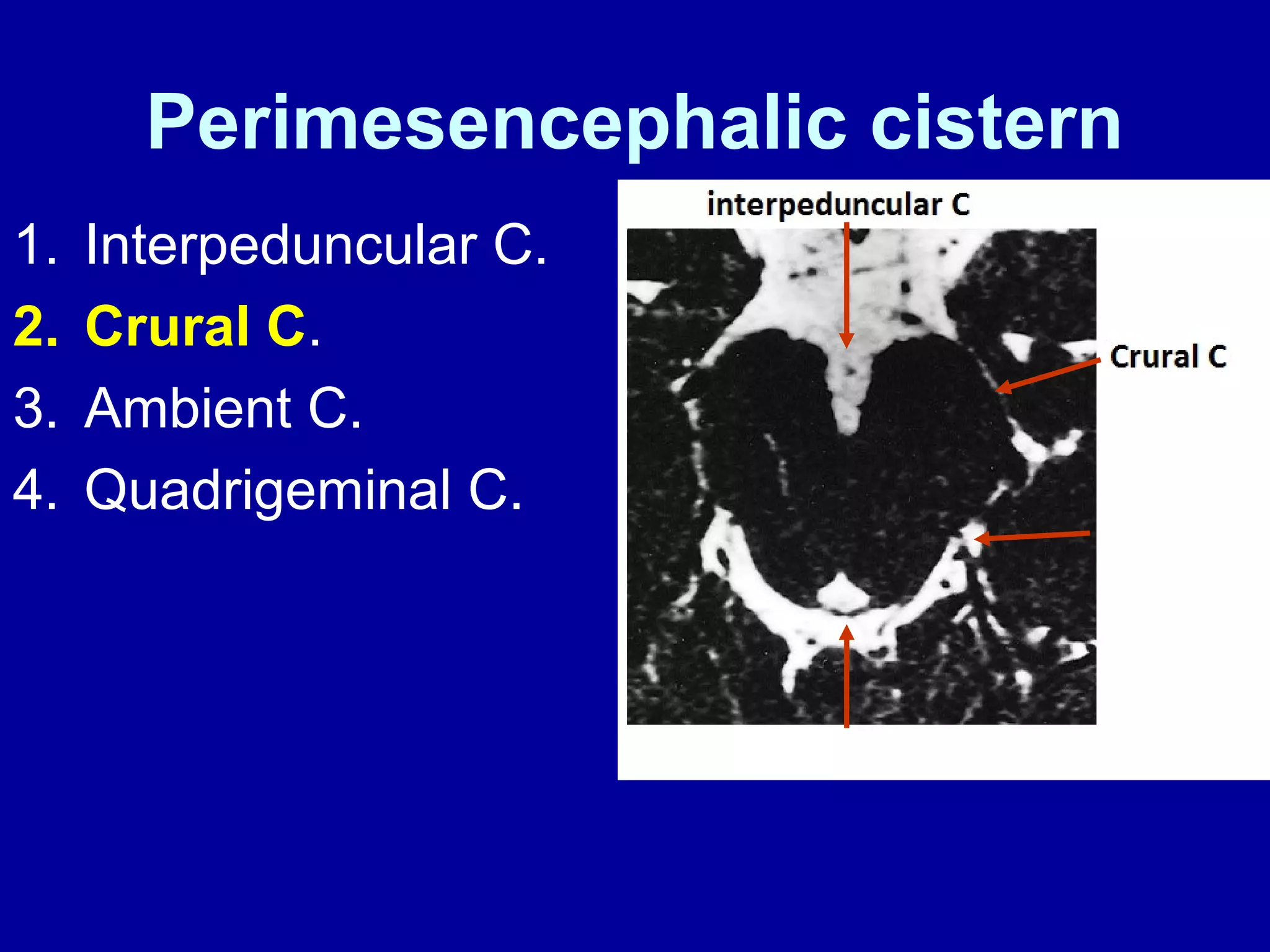 CSF cisterns | PPT