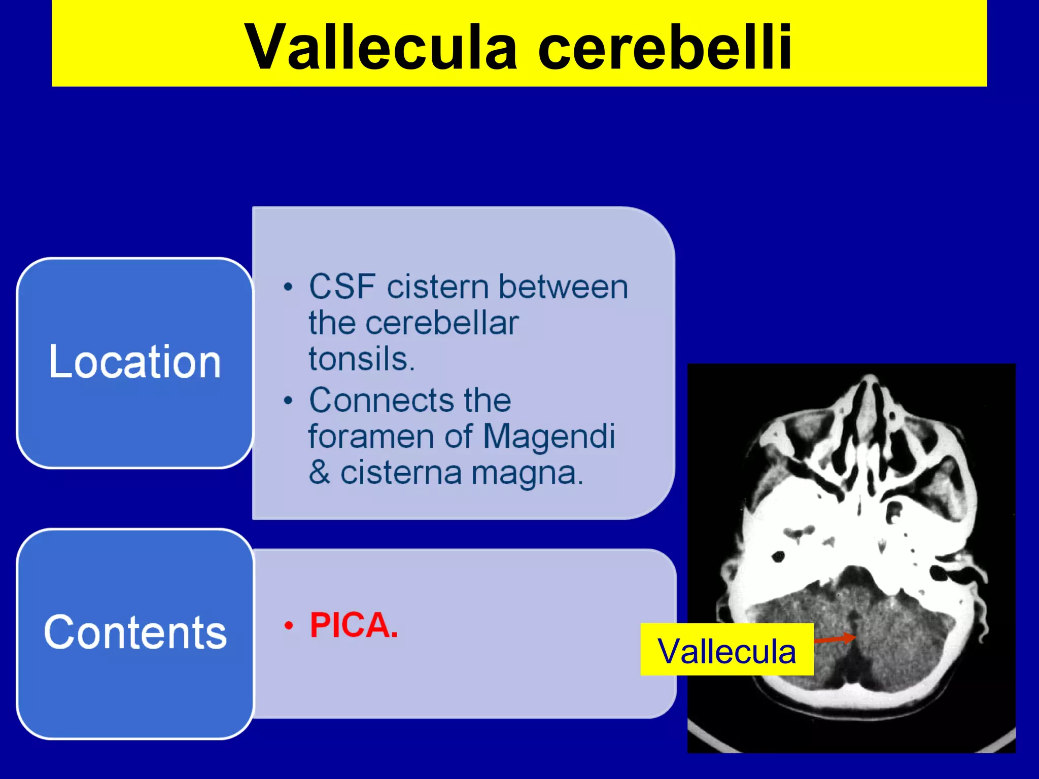 CSF cisterns | PPT