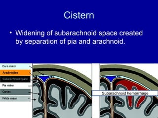 CSF cisterns | PPT