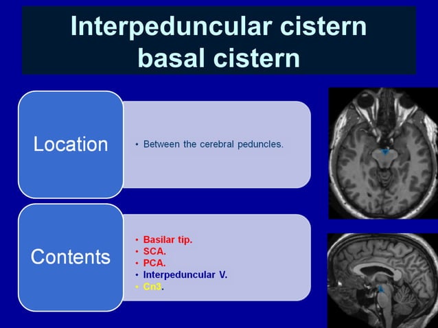 CSF cisterns | PPT