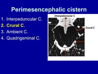 CSF cisterns | PPT