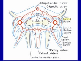 Lamina Terminalis Cistern