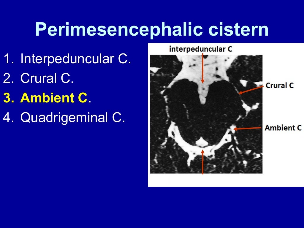 CSF cisterns