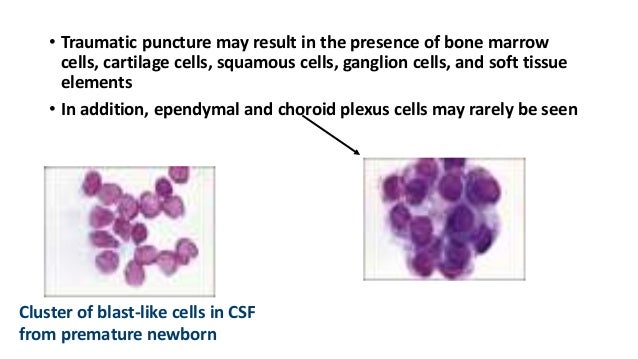 Csf composition and significance by Dr. Ashok KUmar J