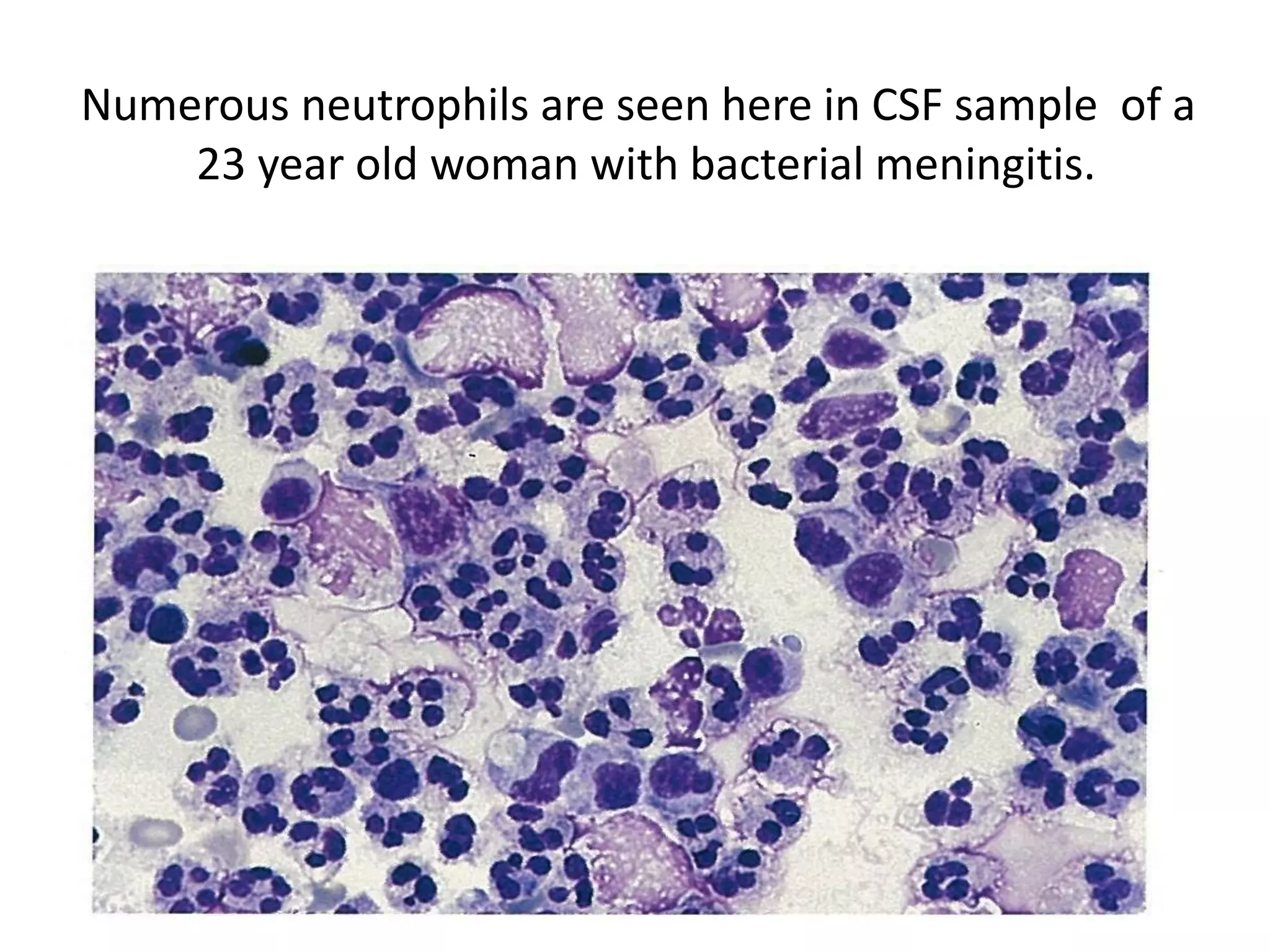 Csf cytological studies and its interpretation1 | PPTX | Brain and ...