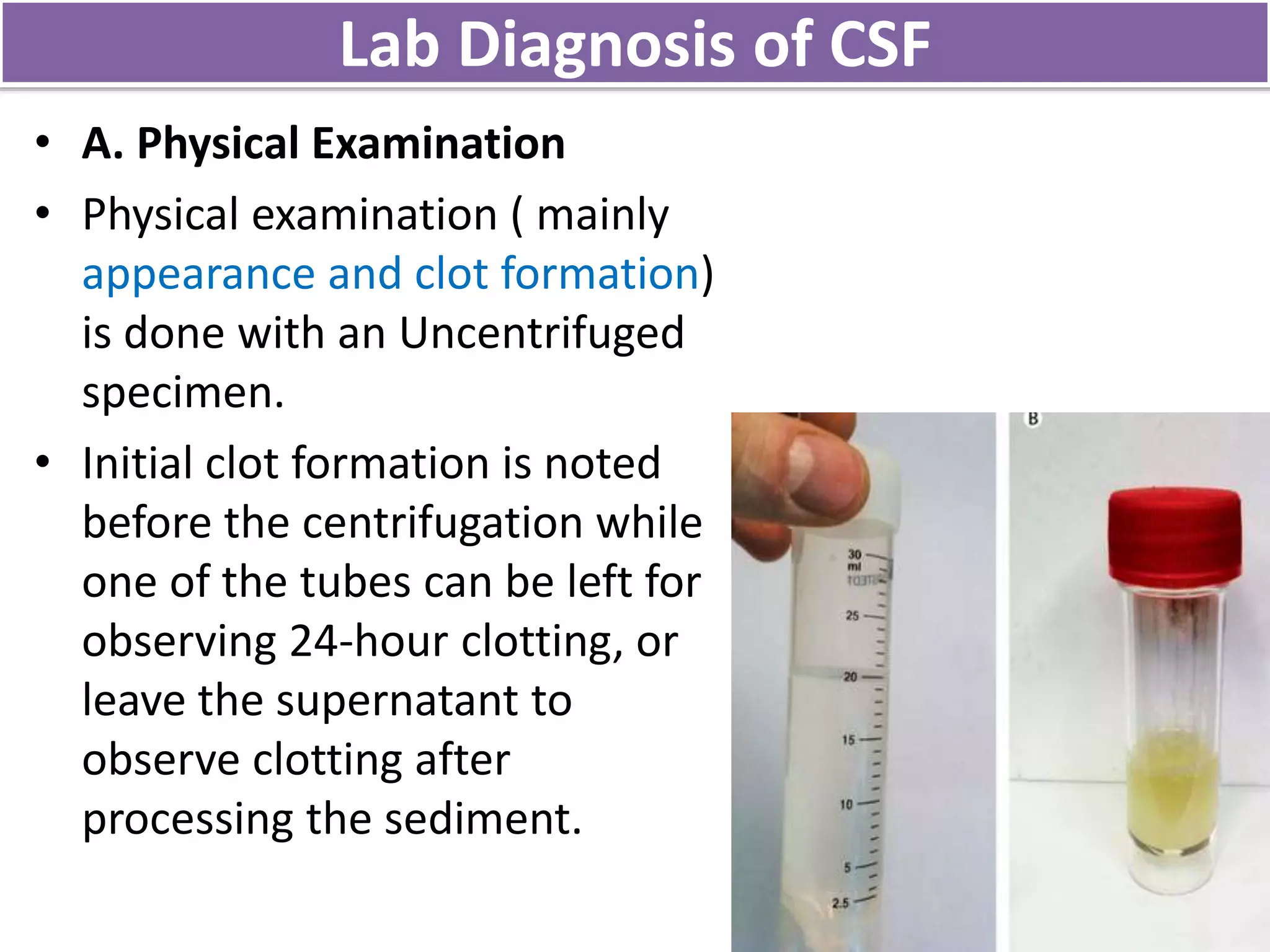 CSF examination | PPTX