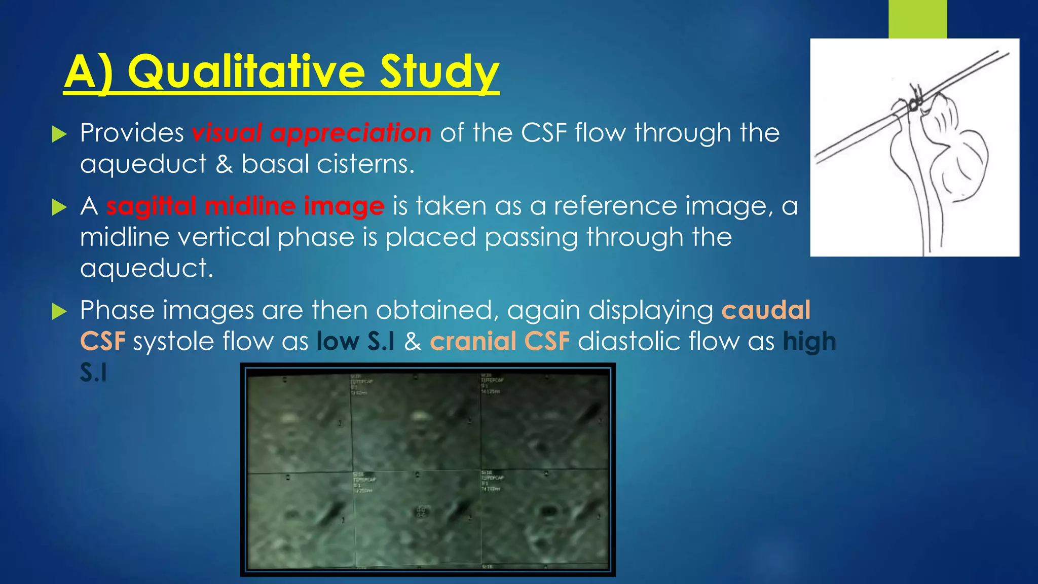 Csf flowmetry | PPTX