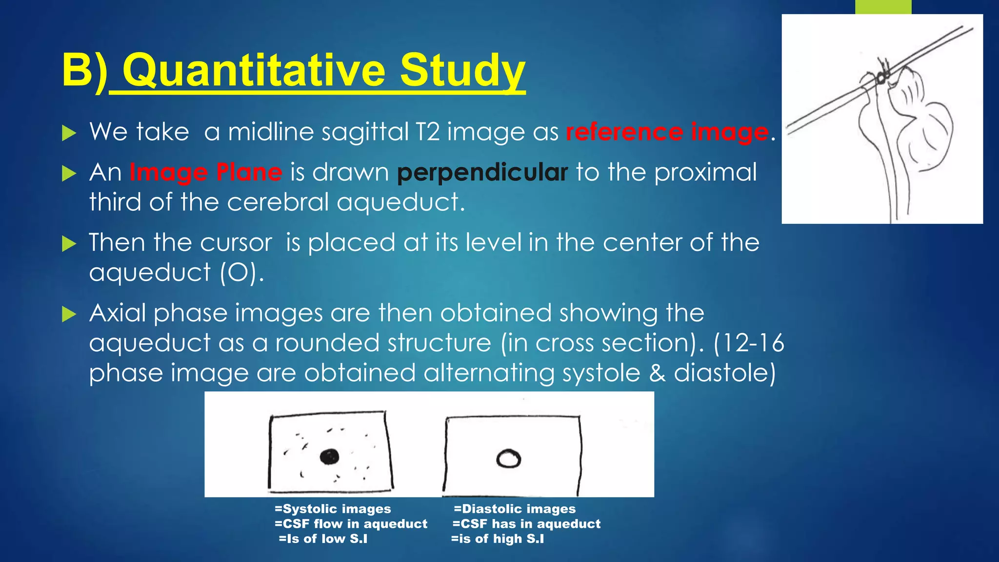 Csf flowmetry | PPTX
