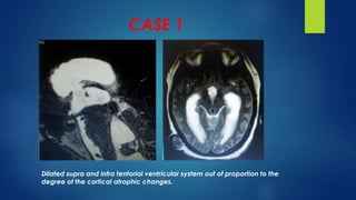 Csf flowmetry | PPTX