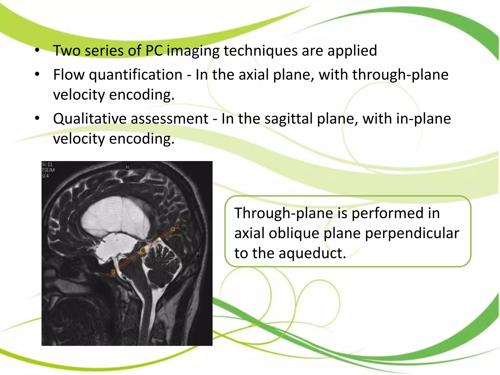 Csf flow study | PPTX