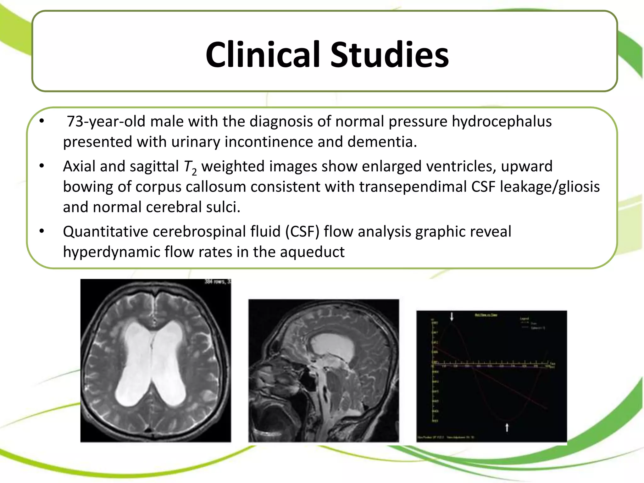 Csf flow study | PPTX