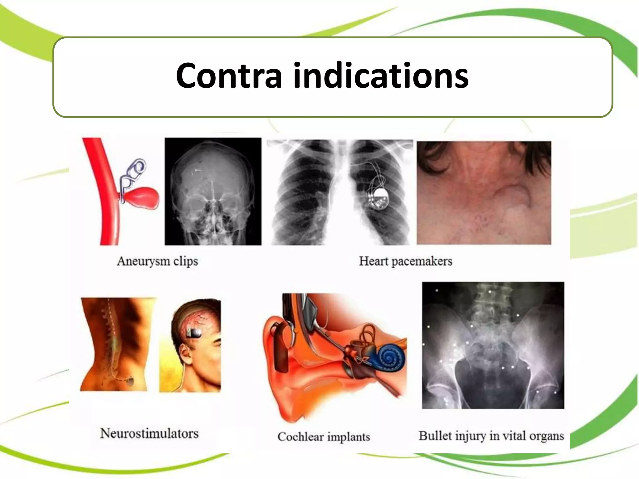 Csf flow study | PPTX
