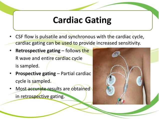 Csf flow study | PPTX