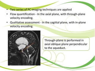 Csf flow study | PPTX