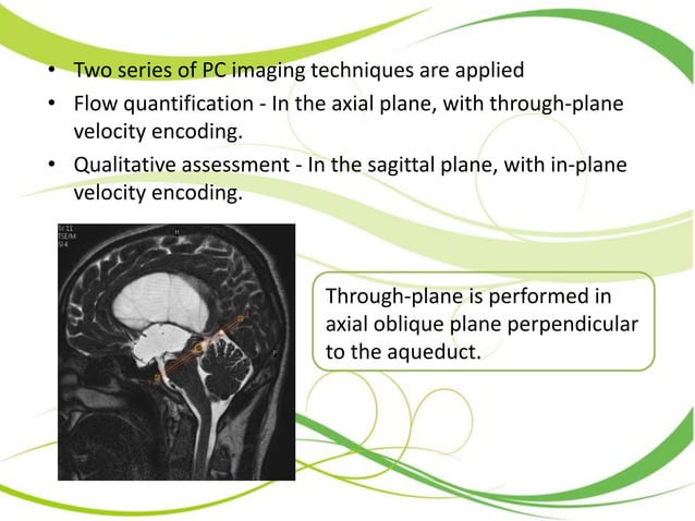 Csf flow study | PPTX