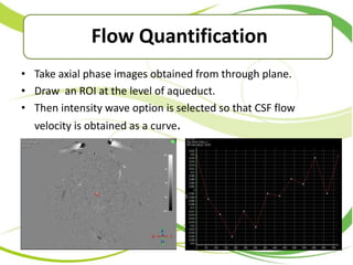 Csf flow study | PPTX