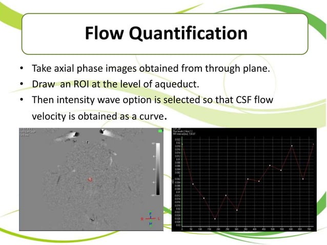 Csf flow study | PPTX